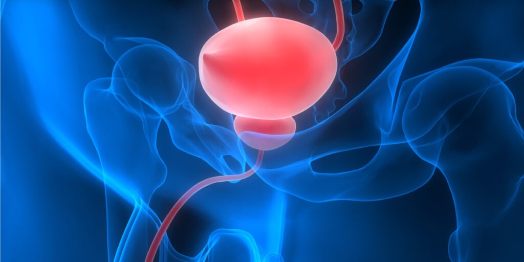 Robotic Surgery for Urologic Conditions | Advanced Urology