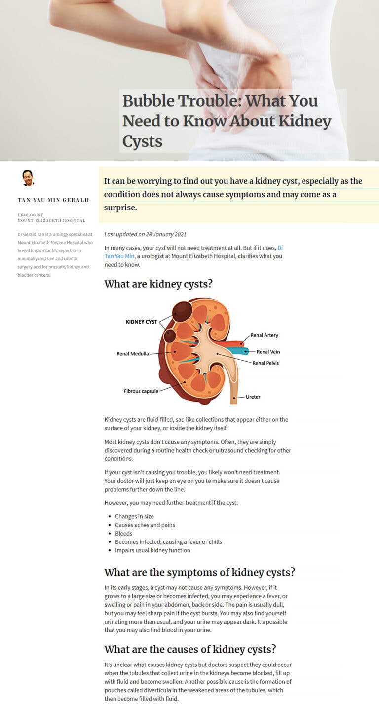 What you need to know about Kidney Cysts | Advanced Urology
